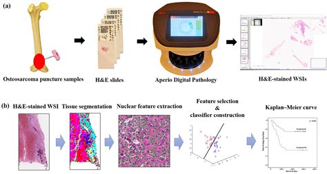 Predicting Recurrence In Osteosarcoma Via A Quantitative Histological Image Classifier Derived
