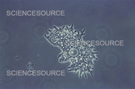 Amoeba Proteus Lm Stock Image Science Source Images