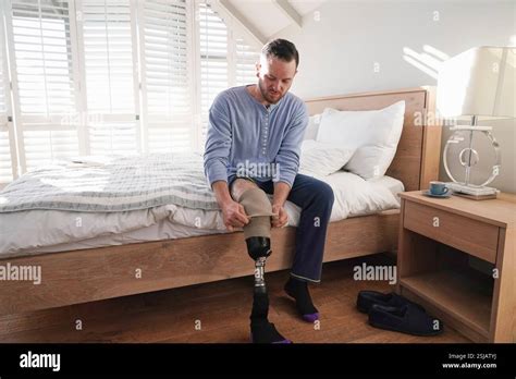 Man Attaching Leg Prosthesis Stock Photo Alamy
