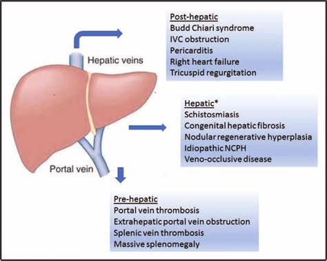 Classification Of Noncirrhotic Portal Hypertension Partial List Of