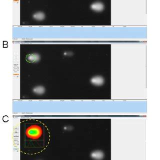 Comet Assay Analysis Using Comet Assay Software A Representative