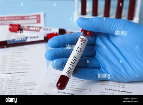 Scientist Holding Tube With Blood Sample And Label Hiv Test Near
