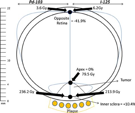 Dose Gradient Along The Central Axis Of The Plaque Download Scientific Diagram