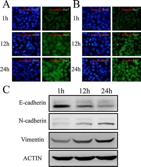 Sers Biosensor For Detection Of Telomerase Activity In Lc Ijn