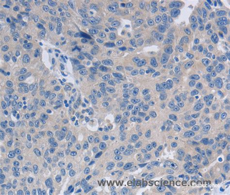 High Affinity And Specificity Grin1 Polyclonal Antibody E Ab 15806 At