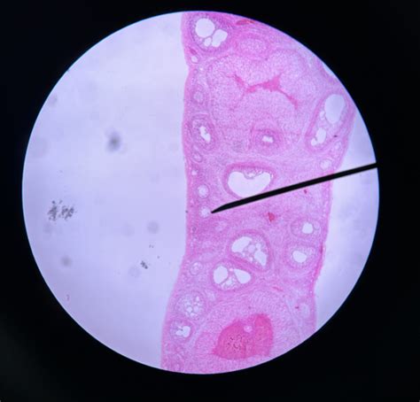 A P Lab Reproductive Flashcards Quizlet