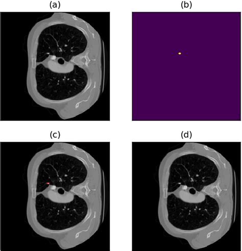 Figure 1 From Lung Nodule Segmentation Via Semi Residual Multi