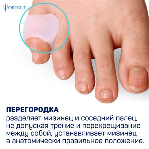 Купить разделитель для мизинца с защитным лепестком под стопу в ...