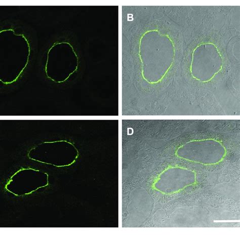 Indirect Immunofluorescence Microscopy A And C And Overlay With