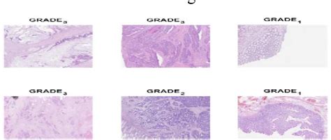 Figure 1 From Deep Transfer Learning Methods For Classification