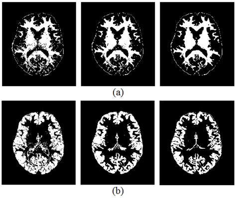 Respectively From Left To Right Consist Of Segmentation Via Ga Pso And