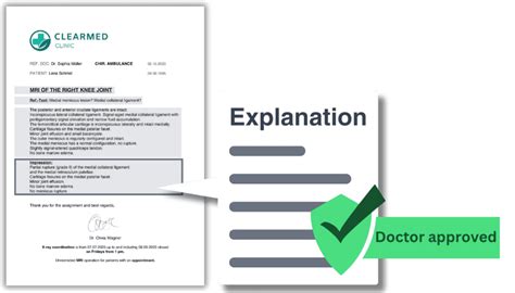 Node Explanation