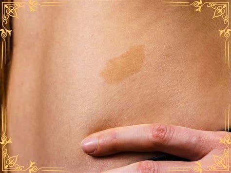 Birthmark On Buttock Meanings For Females And Males What Spiritual