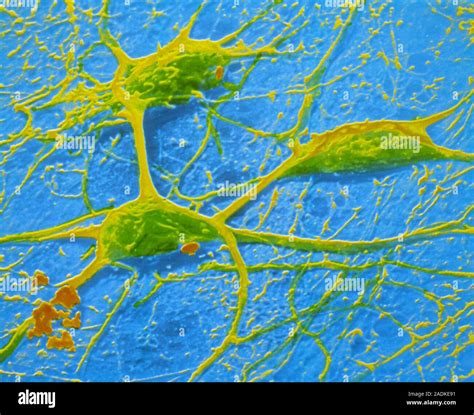 False Colour Scanning Electron Micrograph Sem Showing Three Neurones