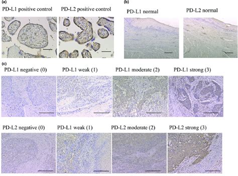 Representative Staining Patterns Of The Samples A Placenta Was Download Scientific Diagram