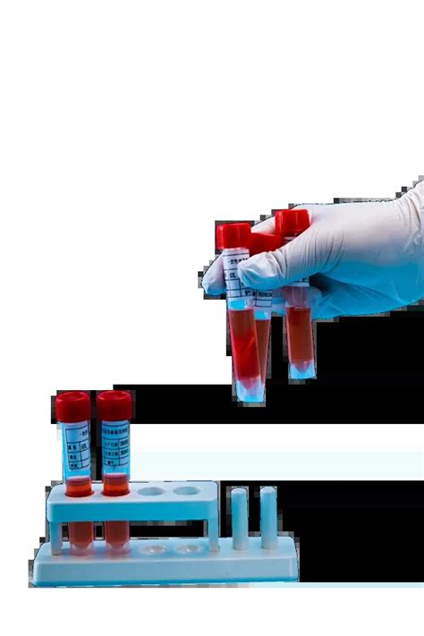 试管试剂核酸检测医疗用品png 花瓣网