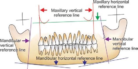 Schematic Diagram Of Opg Showing Horizontal And Vertical Reference