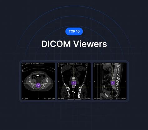 10 Best DICOM Viewers For Medical Images 2024 Update