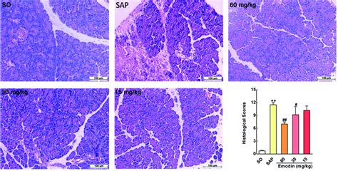 Emodin Improved Pancreatic Histopathology Of Sap Rats Effect Of Emodin
