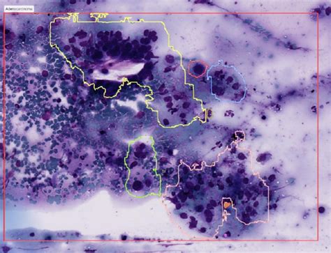 An Example Of Model Predictions For Tumor Cell Detection And Type Download Scientific Diagram