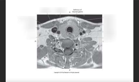 Sectional Anatomy Diagram Quizlet