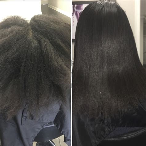 Natural Texture Smoothing Treatment