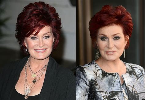Sharon Osbourne Before Plastic Surgery Before And After Face Photos