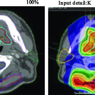 Example Of Image Feature Extraction Download Scientific Diagram