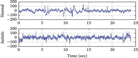 Examples Of Raw Normal EEG Signals And An Autistic EEG Signal Djemal