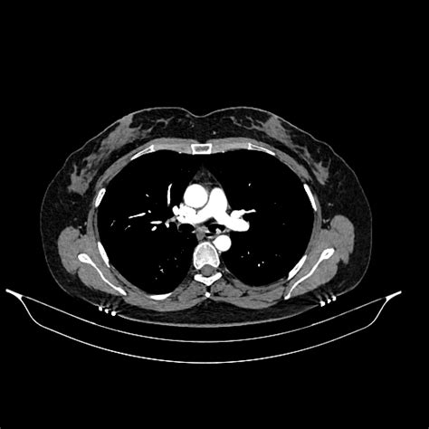 Image Radiopaedia Org
