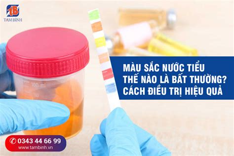 Thận ứ nước Nguyên nhân triệu chứng và cách điều trị
