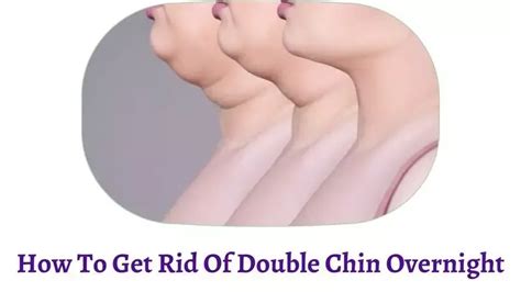 How To Get Rid Of Double Chin Overnight Million Knowledge