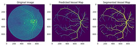 Retina Fundus Images Segmentation For Vesgen Image Analysis Image
