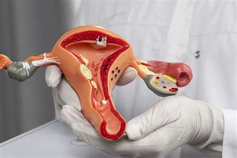 Mengenal Pap Smear Memahami Pentingnya Untuk Kesehatan Wanita Pkbi