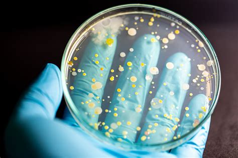 미생물학 실험실에서 교육을 위한 토양 샘플에서 천접시에서 자라는 특성과 다양한 모양의 박테리아 및 곰팡이 의 배경 0명에 대한 스톡 사진 및 기타 이미지 Istock