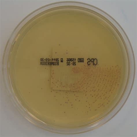 Streptococcus Pyogenes Group A Streptococcus On Chromid … Flickr