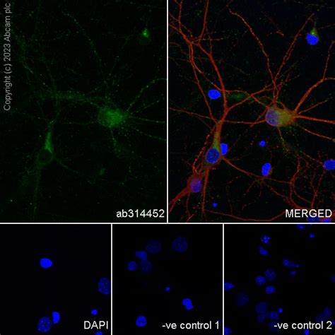Map2抗体[hm 2] Neuronal Marker Ab11267 Abcam中文官网