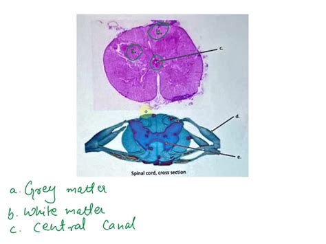 Solved Label The Following Structures On The Spinal Cord A Gray
