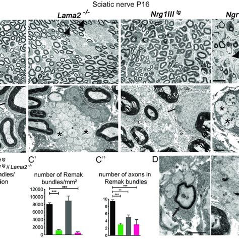 Neuregulin Type Iii Nrg Iii Overexpression Worsens The Radial