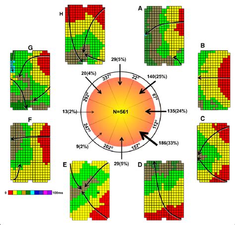 Examples Of Pulmonary Vein Area Pva Activation Patterns Typical
