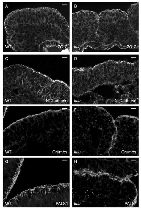 Tjp2 Mgi Mouse Gene Detail Mgi1341872 Tight Junction Protein 2