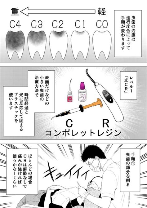 何をされているか分からないから歯医者が怖いという人のために元歯科助手が治 小西 真冬 さんのマンガ ツイコミ 仮