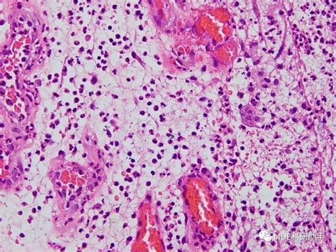 切片学习 常规病理组织切片及诊断要点 知乎