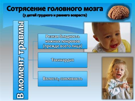 Черепно мозговая травма у детей презентация онлайн