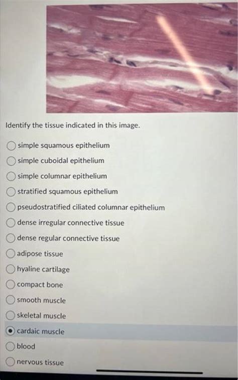 Solved Identify The Tissue Indicated In This Image Simple Squamous Answer Transtutors