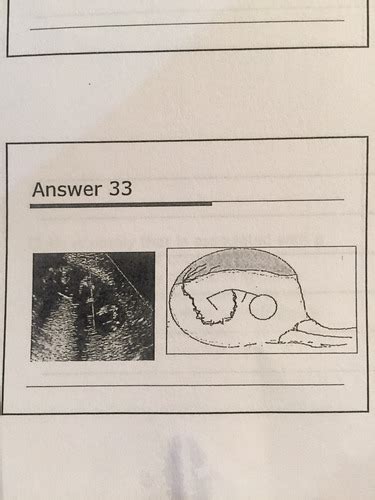Ob 6 Flashcards Quizlet
