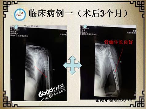 文章详情