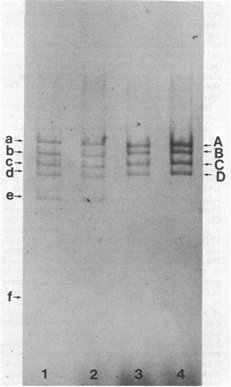 Ecori Restriction Fragments Of Pgy14 And Pyf91 Plasmid Dna Lane 1 Download Scientific Diagram