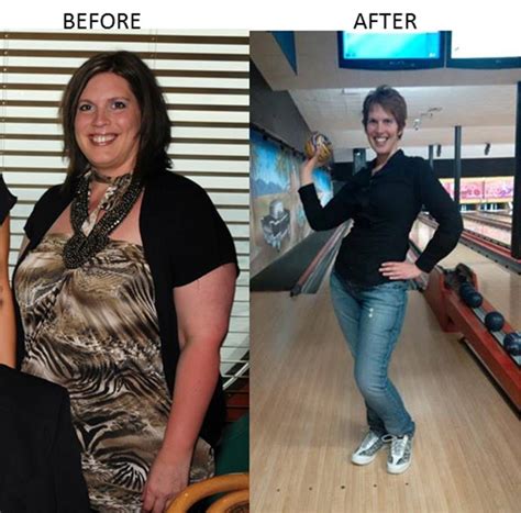 American Patient Praises Gastric Sleeve Surgery In Mexico After Losing