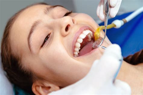 深圳龙华区爱康健口腔医院洗牙价格 深圳爱康健口腔医院